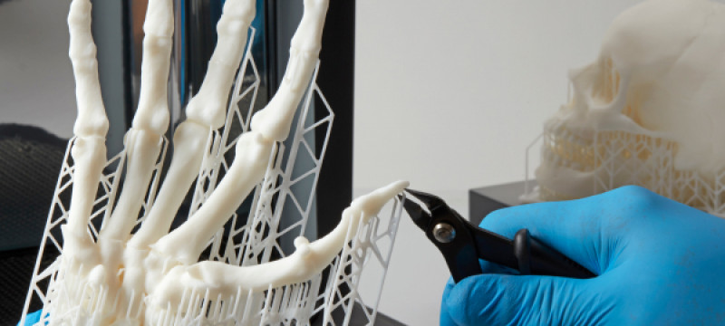3D printing in medicine - the use of 3D technologies in medicine