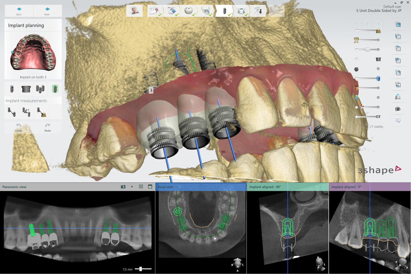 Formlabs Surgical Guide Resin Купить - 3DDevice